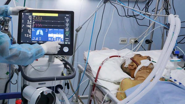 What ECMO Treatment is and How Can You Determine its Success?