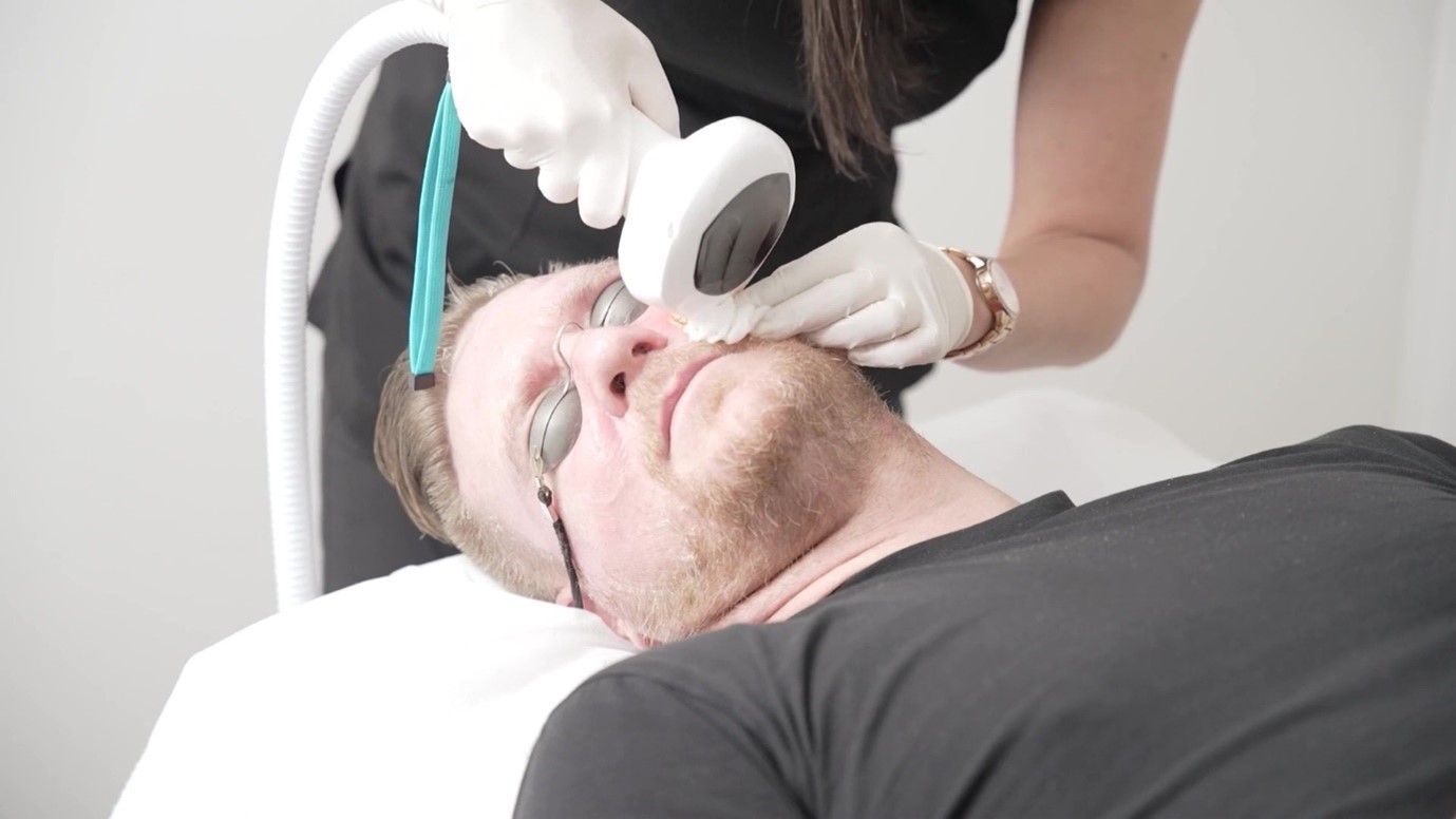 The Impact of Intense Pulsed Light IPL Treatment on Your Health