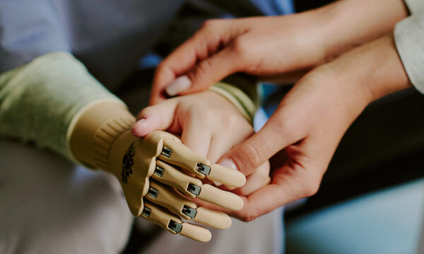 How Injection Molding Supports Advanced Prosthetics